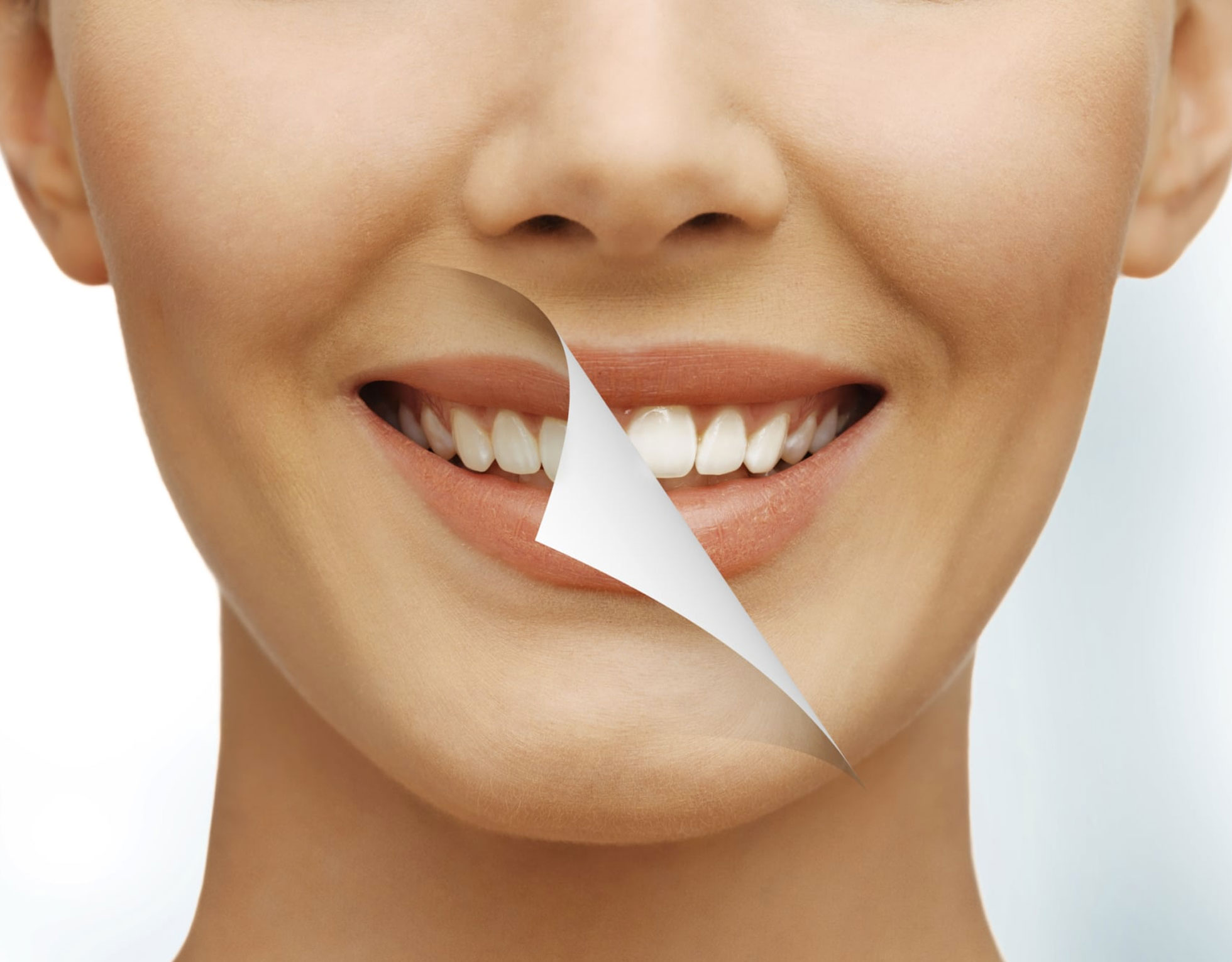 Teeth Whitening? Everything You Need to Know